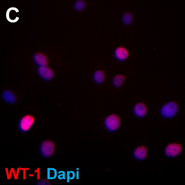 OVCAR-3 Human Ovarian Cancer Cell Line | SCC257